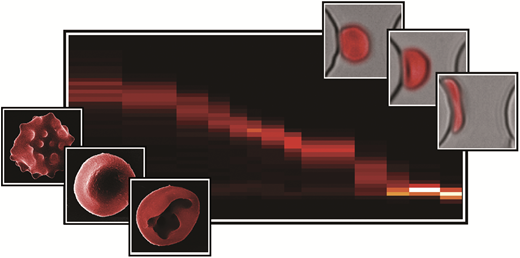 Sorting cells by size, shape and deformability† | Lab on a Chip | The ...
