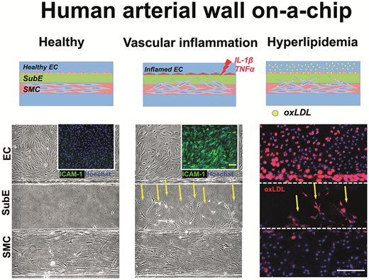 A novel human arterial wall-on-a-chip to study endothelial inflammation ...