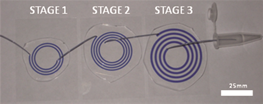 Microfluidic enrichment of a target cell type from a heterogenous ...